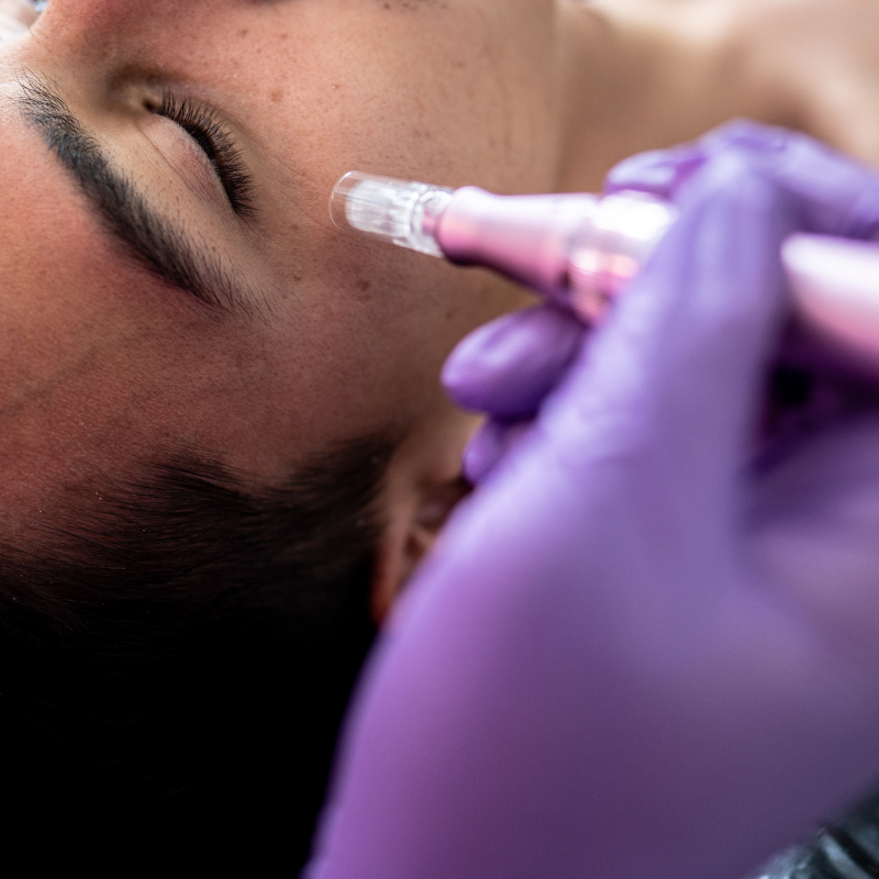 Acupuncture Natural Wellness Pain Relief Clinic North Miami